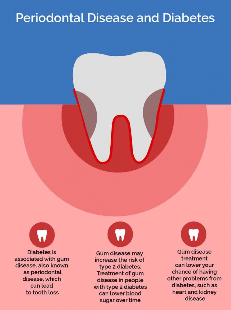 The Mouth-Body Connection - Periodontist in Birmingham, AL - Gum ...