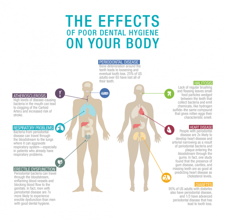 The Mouth-Body Connection - Periodontist in Birmingham, AL - Gum ...